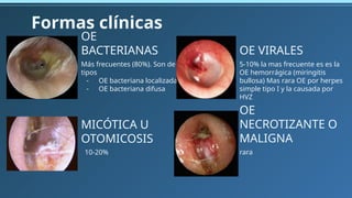 Otitis externa y otitis media aguda.pptx