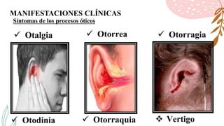 otitis media y otitis externa anatomía y fisiopato | PPTX