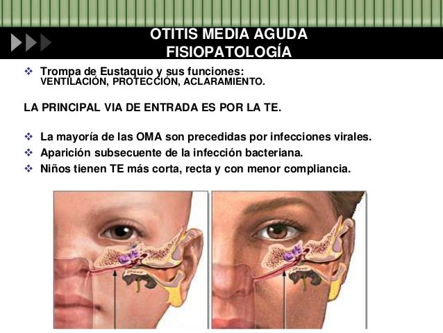 Causas De Otitis Media , Otitis Causas, síntomas y tratamiento – HRBWT
