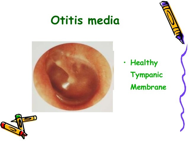 Otitis Media In Children