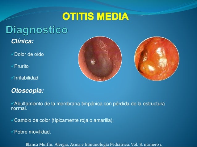 Patología Infecciosa del Oído. Otitis media...