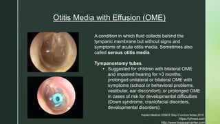 Otitis media | PPT