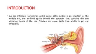 Otitis media | PPTX | Ear, Nose and Throat Conditions | Diseases and ...