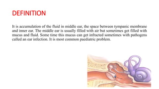 Otitis media | PPTX