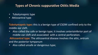 Otitis media | PPTX