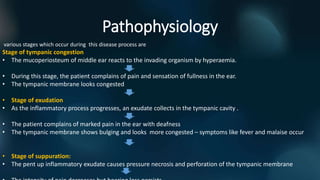 Otitis media | PPTX
