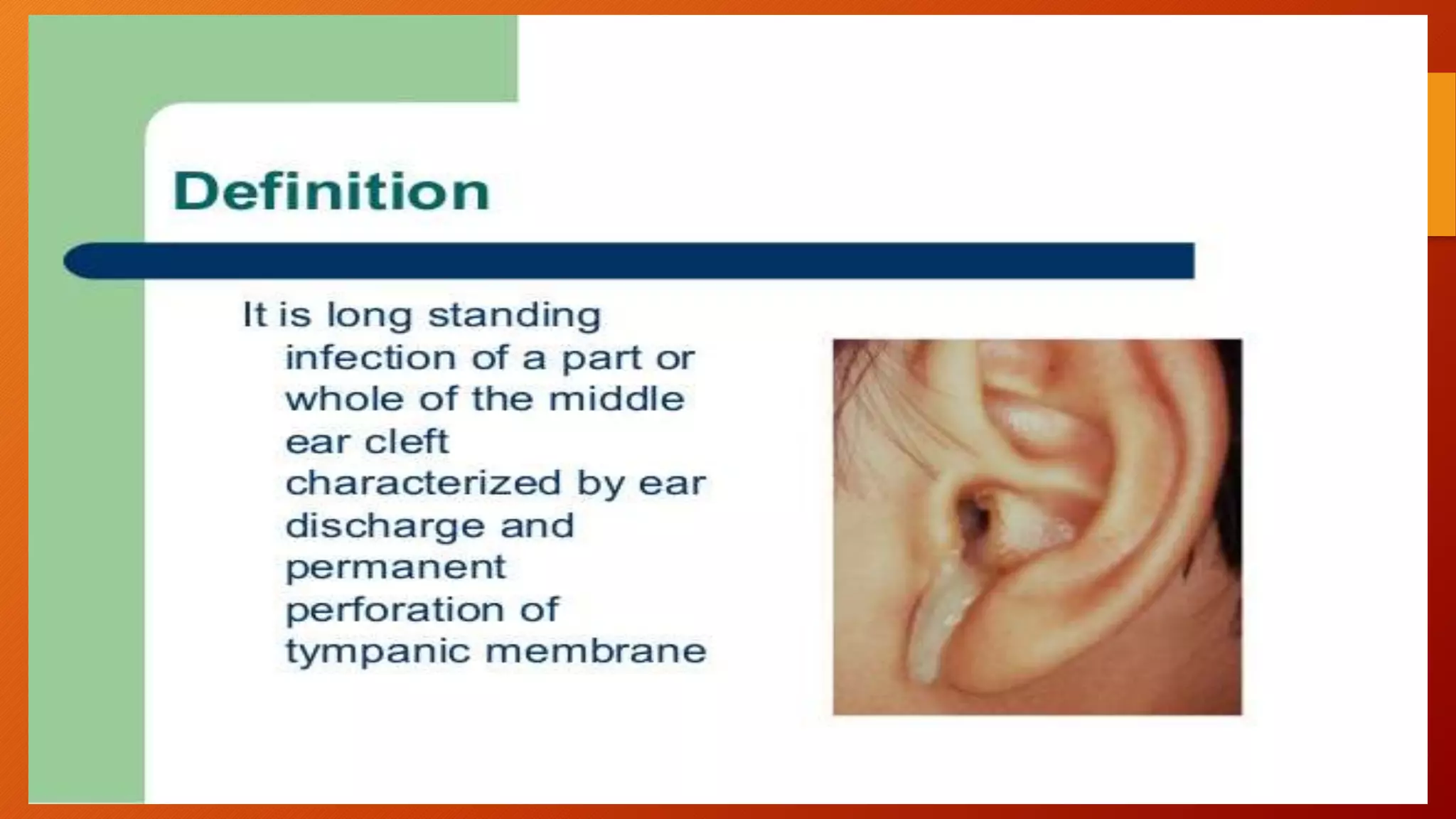 Otitis media ear infection ppt | PPTX