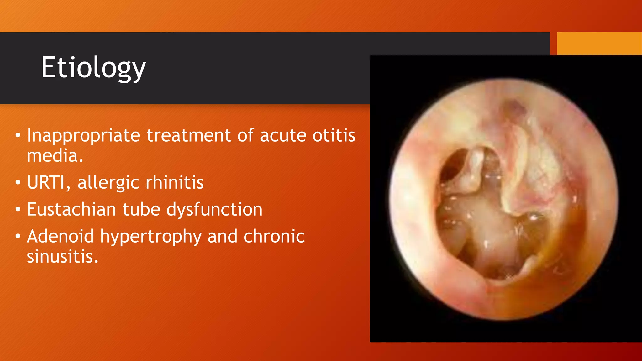 Otitis media ear infection ppt | PPTX