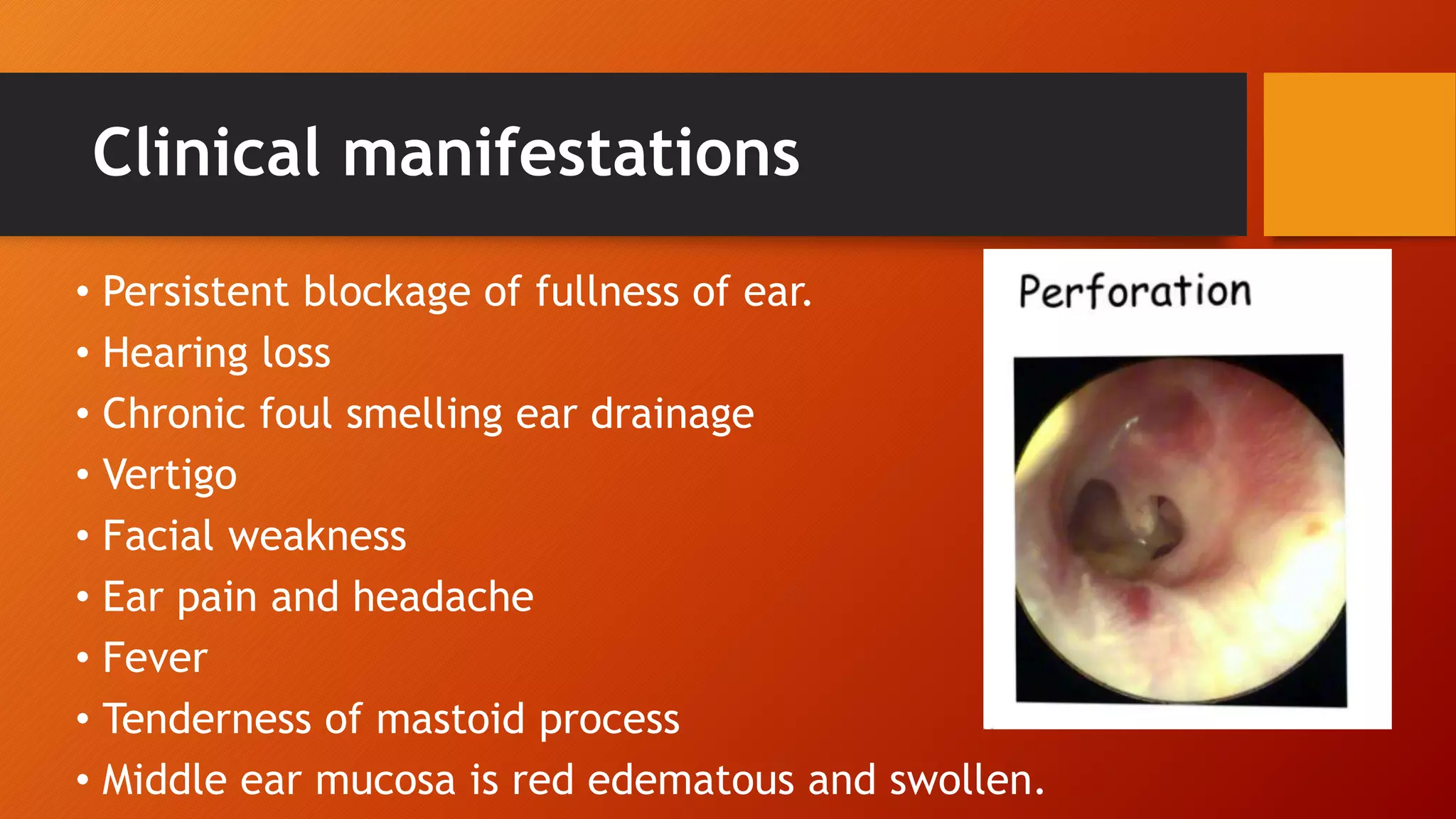 Otitis media ear infection ppt | PPTX