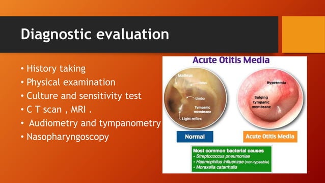 Otitis media ear infection ppt | PPTX | Ear, Nose and Throat Conditions ...
