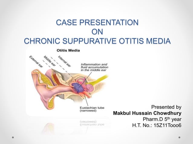 CASE PRESENTATION ON CHRONIC SUPPURATIVE OTITIS MEDIA | PPTX | Ear, Nose and Throat Conditions ...