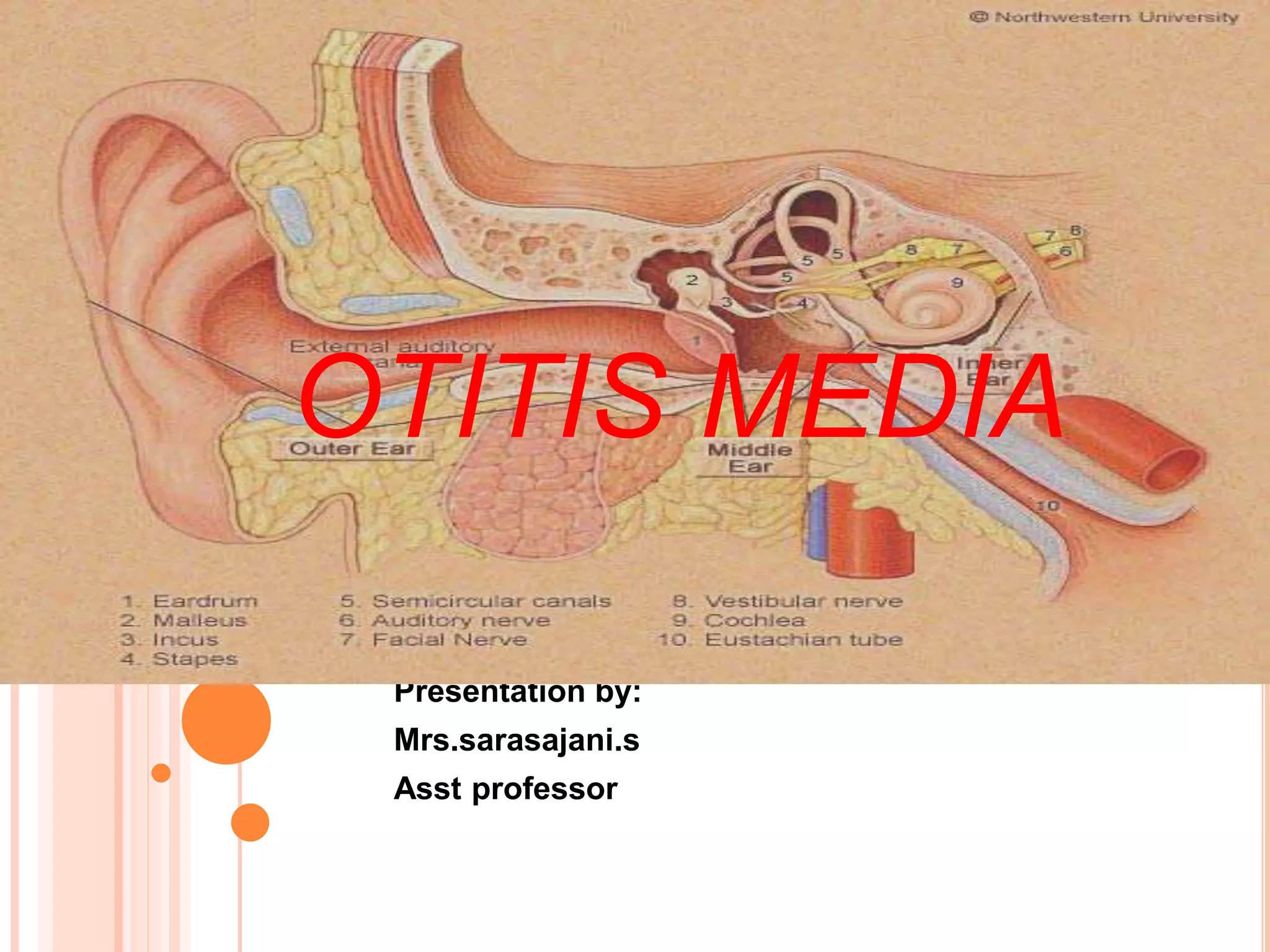 Otitis media | PPT