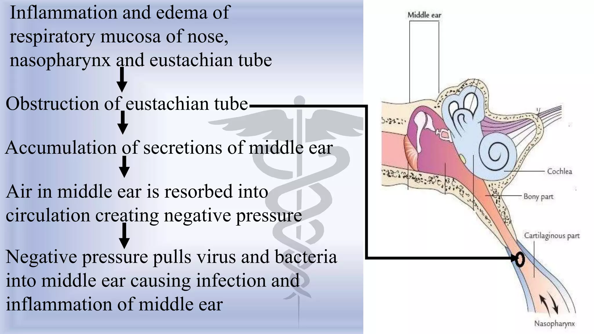 Otitis Media ENT and Microbiology | PPTX