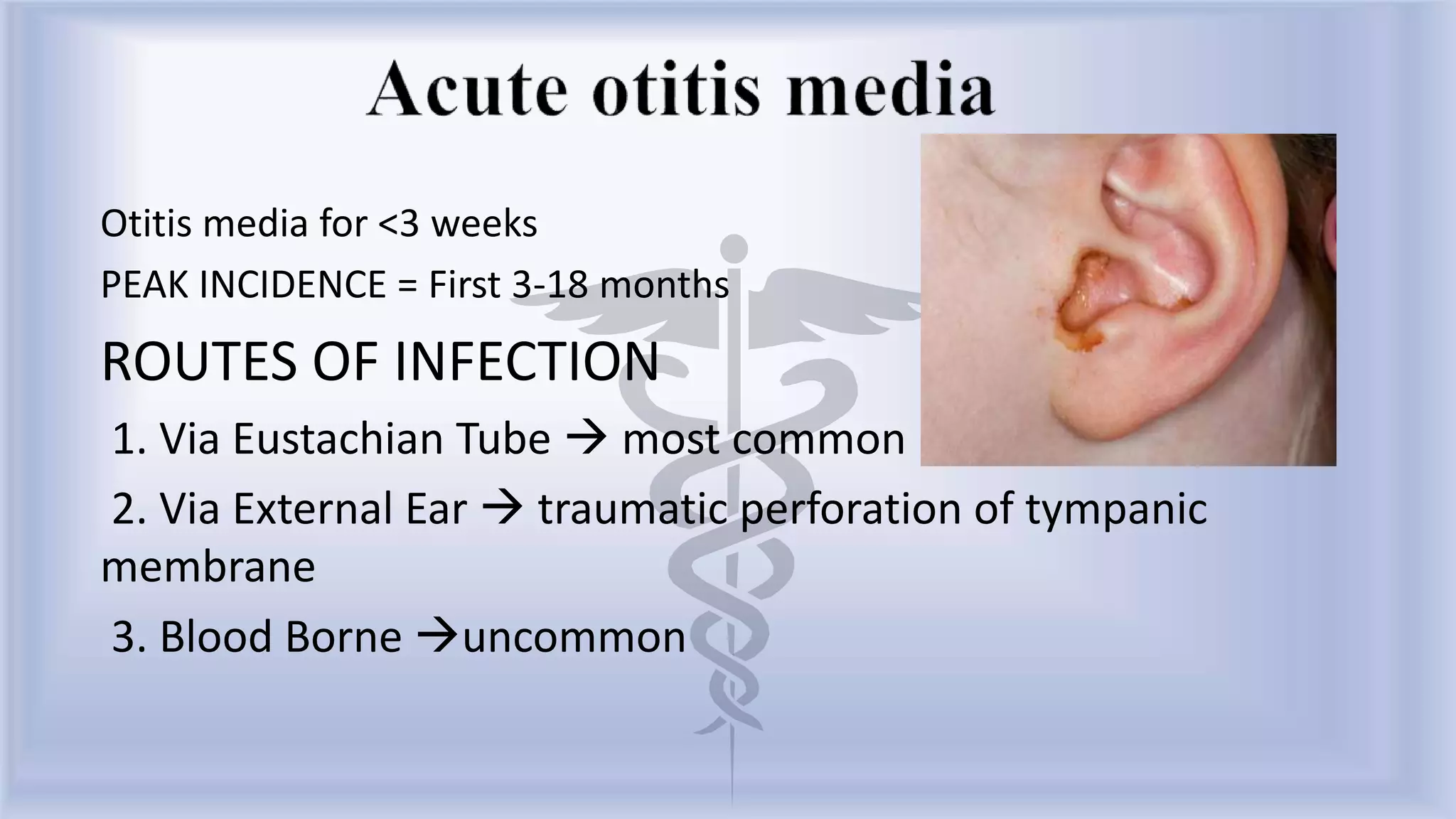 Otitis Media ENT and Microbiology | PPTX