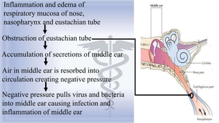 Otitis Media ENT and Microbiology | PPTX