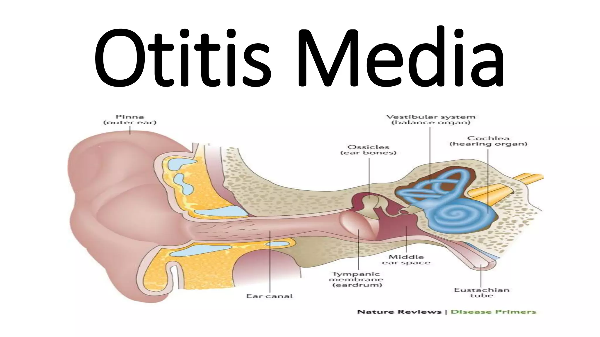 Otitis media | ear infection | PPTX