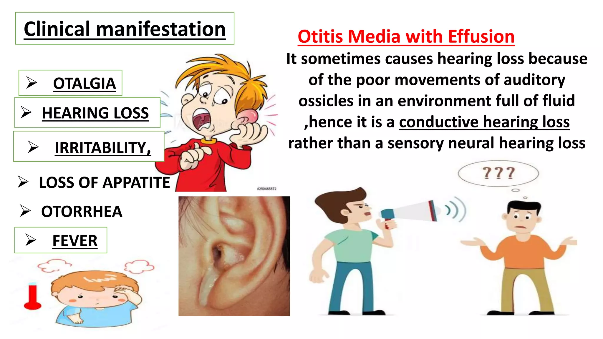 Otitis media | ear infection | PPTX