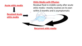 Otitis media | ear infection | PPTX