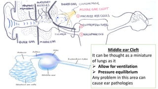 Otitis media | ear infection | PPTX