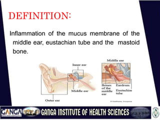 OTITIS MEDIA.pptx