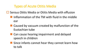 OTITIS MEDIA.pptx