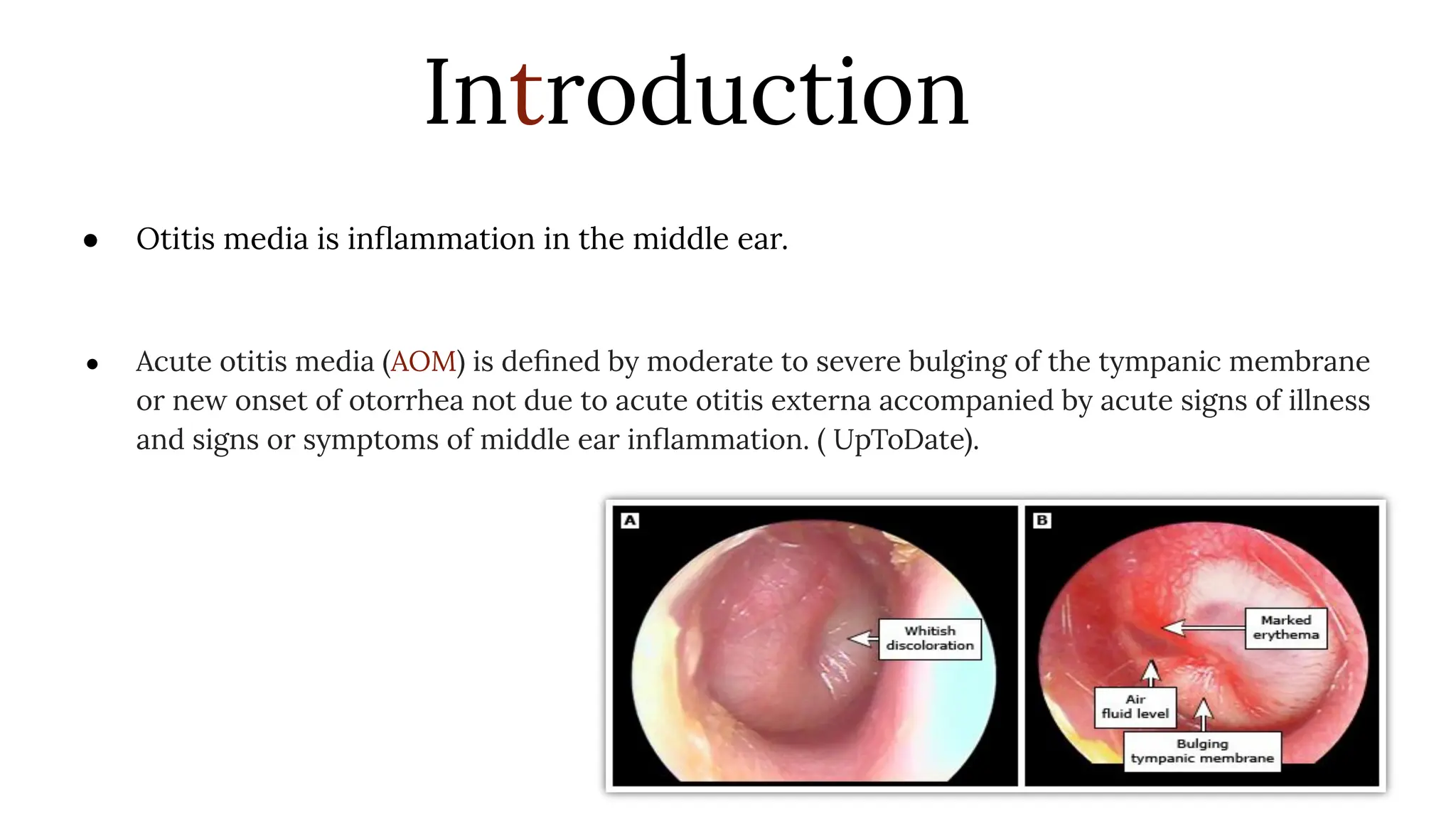 Otitis Media.pdf