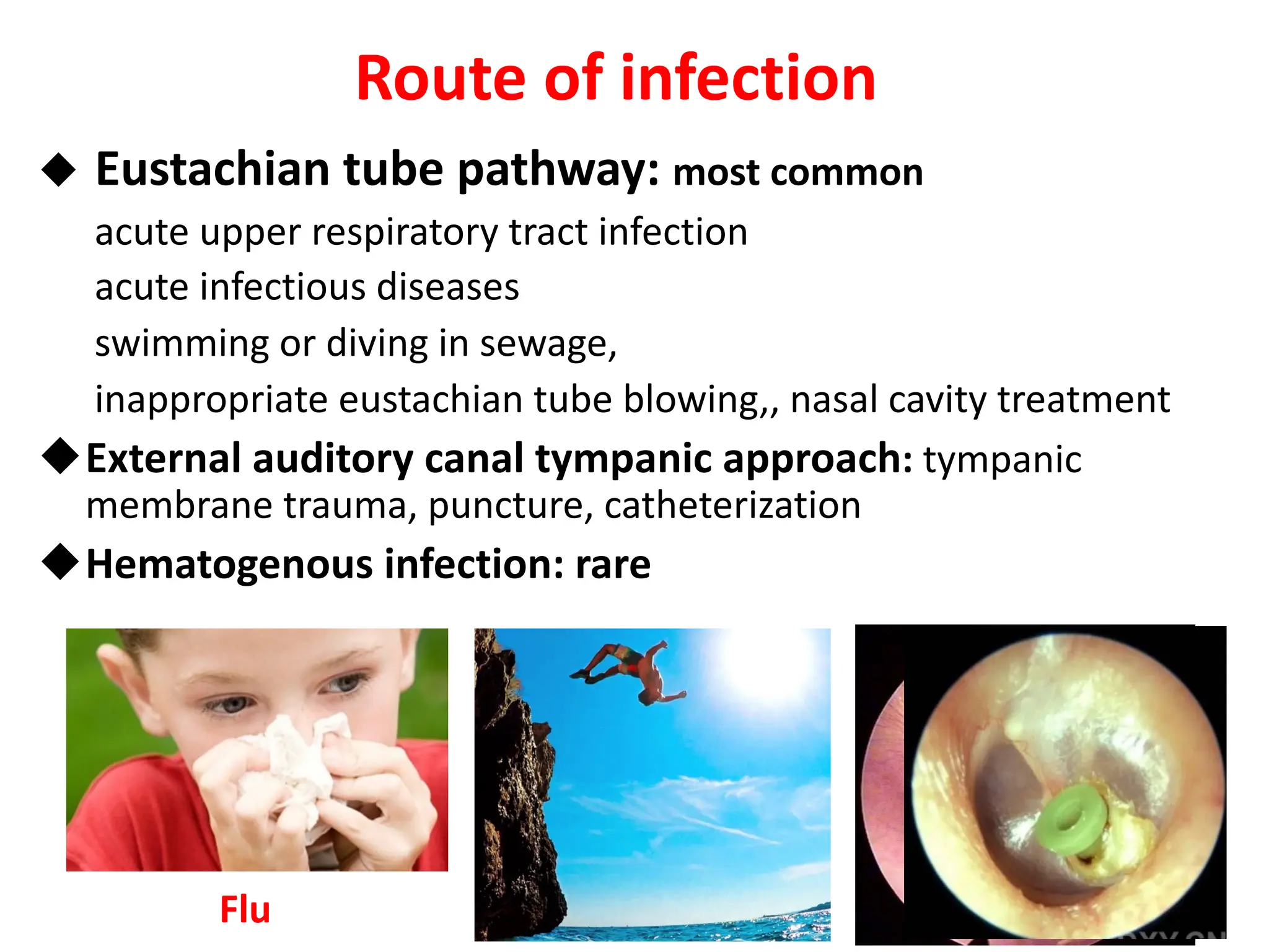otitis media is the internal infection of ear which causes swelling of ...