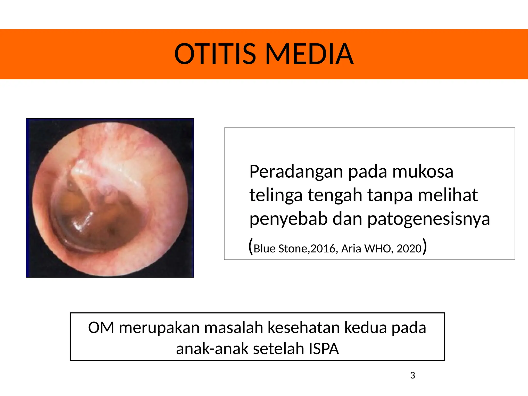 otitis media adalah infeksi pada telinga tengah | PPTX