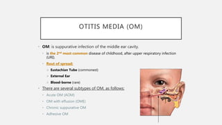 Otitis media | PPTX