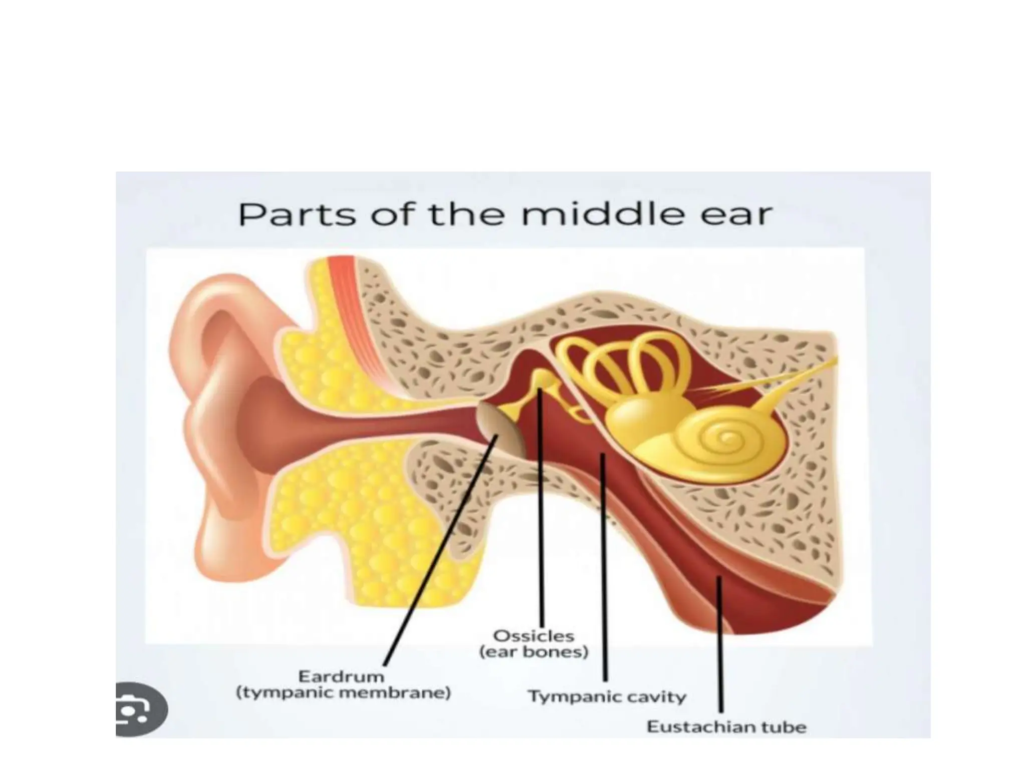 Otitis Media 3.pptx