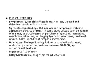 Otitis Media 3.pptx