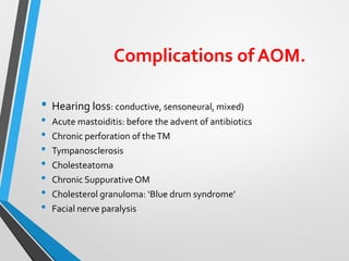 Otitis Media_729758e1424f96aa59a699aaff5ebb0f.pdf