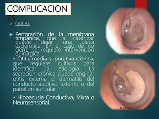 OTITIS MEDIA AGUDA - DR. OMAR GONZALES SUAZO. | PPTX