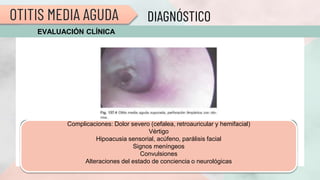 Otitis media aguda.pptx