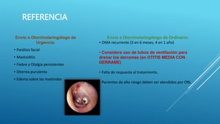 OTITIS MEDIA AGUDA gpc tratamiento y diagnostico.pptx