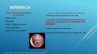 OTITIS MEDIA AGUDA..................pptx