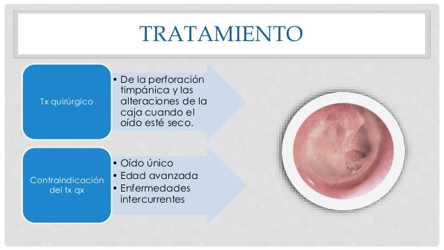 Tratamento De Membrana Timpanica Rompida