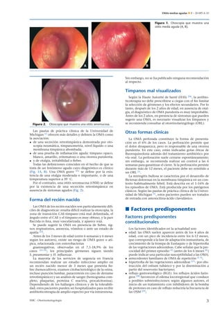 Otitis media aguda- Otorrinolaringologia | PDF