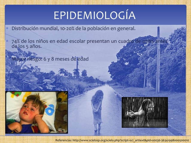 Otitis Media Aguda Viral Ppt