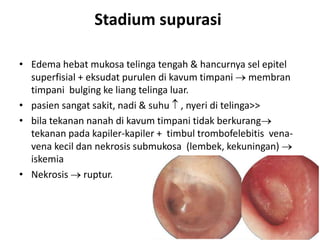 Otitis media akut | PPTX