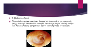 otitis Media Akut.pptx