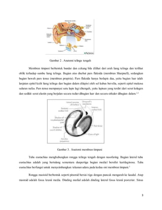 Otitis media akuta | DOCX
