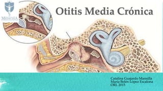 Otitis Media Crónica