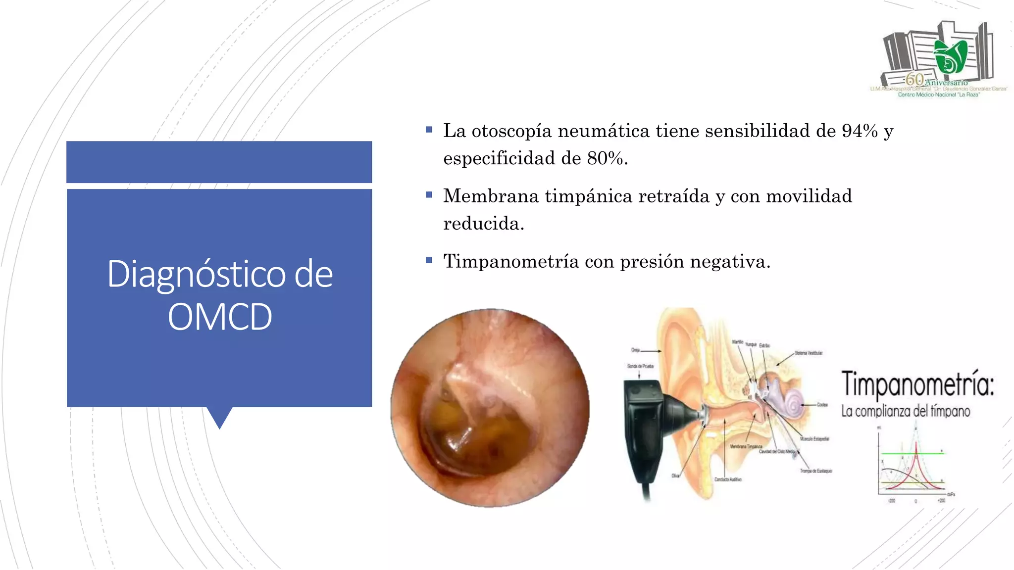 Otitis Media Crónica Con Derrame Ppt