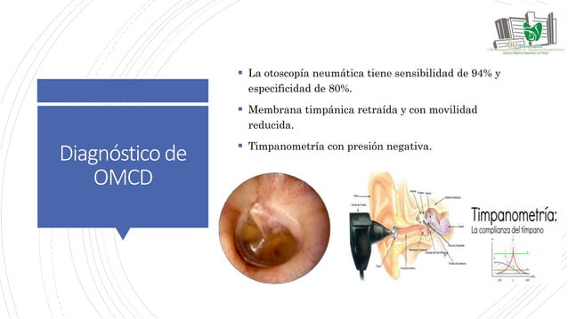 Otitis Media Crónica Con Derrame Ppt