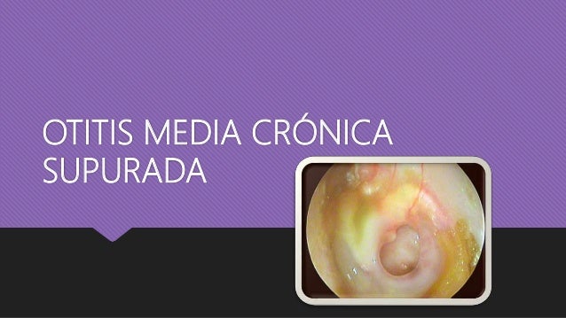 Otitis media crónica supurada