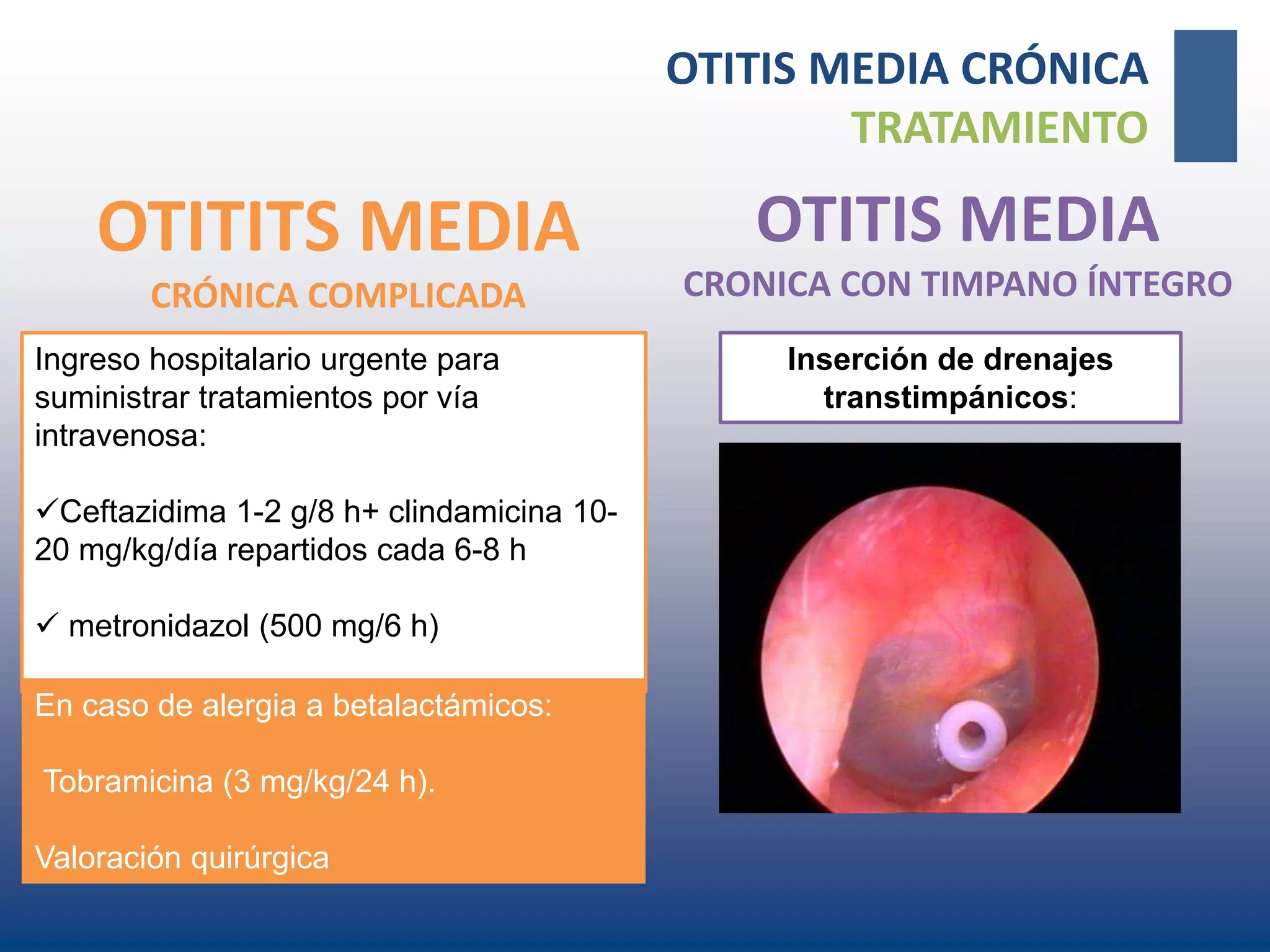 Otitis media cronica | PPTX