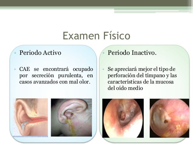 Otitis media cronica