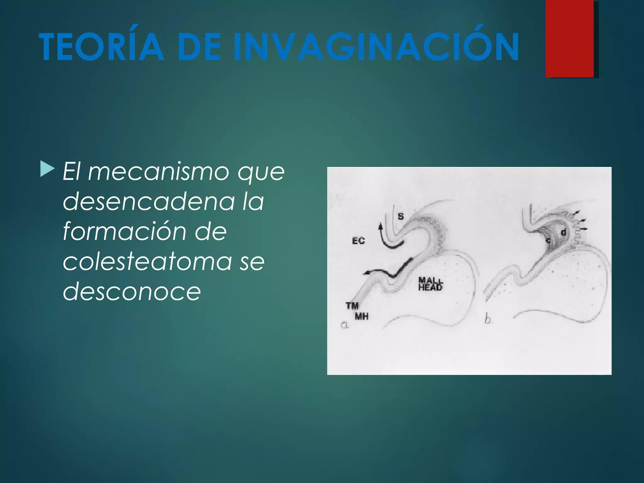 OTITIS MEDIA CRONICA COLESTEATOMA | PPT