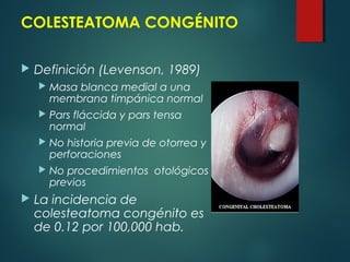 OTITIS MEDIA CRONICA COLESTEATOMA | PPT